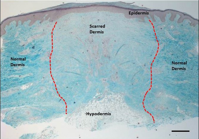 New approaches to soft tissue reconstruction involving adipose tissue ...