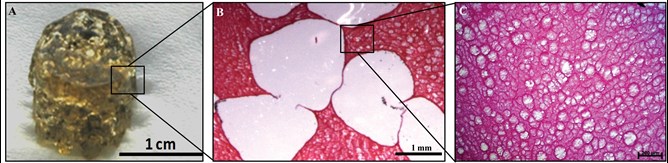 New approaches to soft tissue reconstruction involving adipose tissue ...
