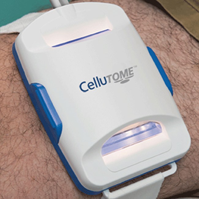 Could epidermal grafting be the solution to vitiligo? | The PMFA Journal