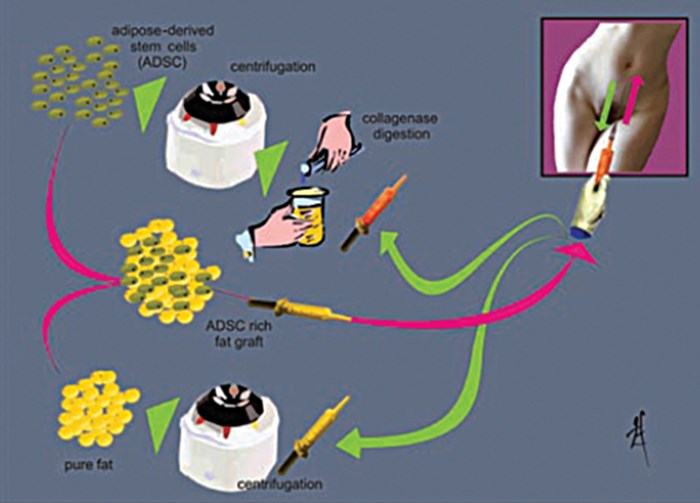 The future and a summary of the past | The PMFA Journal