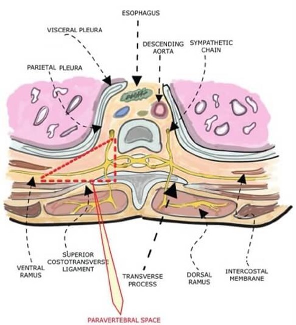 Safety and risks of local anaesthesia and regional blocks in plastic ...