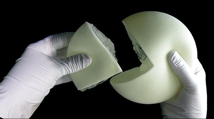 Perspectives on: Polyurethane covered breast implants | The PMFA Journal