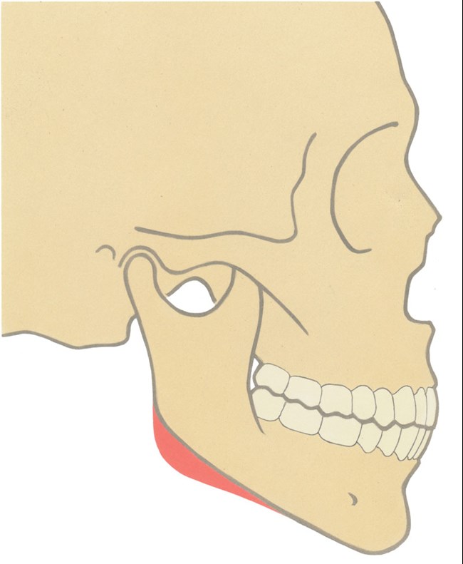 Contemporary aesthetic management strategies for deficient jaw angles ...