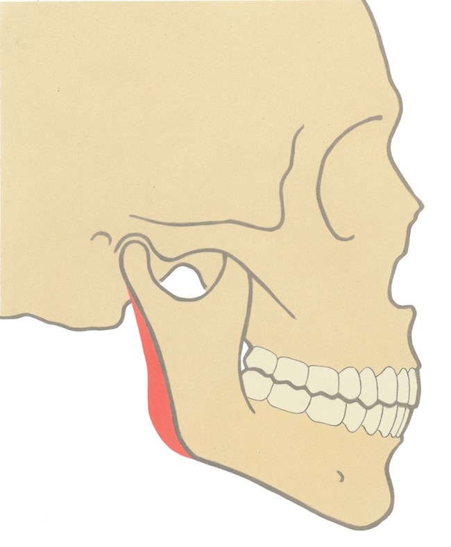 Contemporary aesthetic management strategies for deficient jaw angles ...