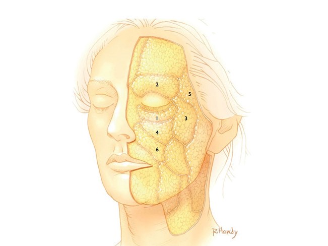 HOW I DO IT Peri-orbital rejuvenation using HA fillers | The PMFA Journal