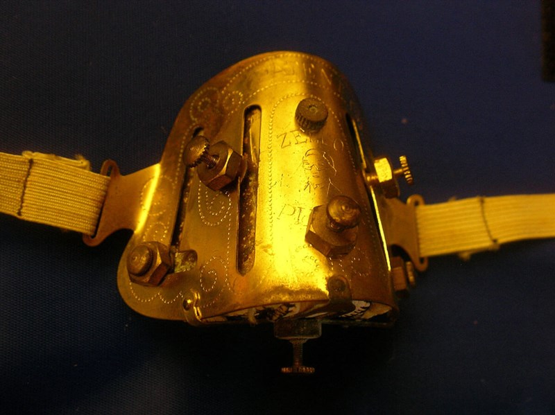 The golden nose – reshaping the nose 100 years ago | The PMFA Journal