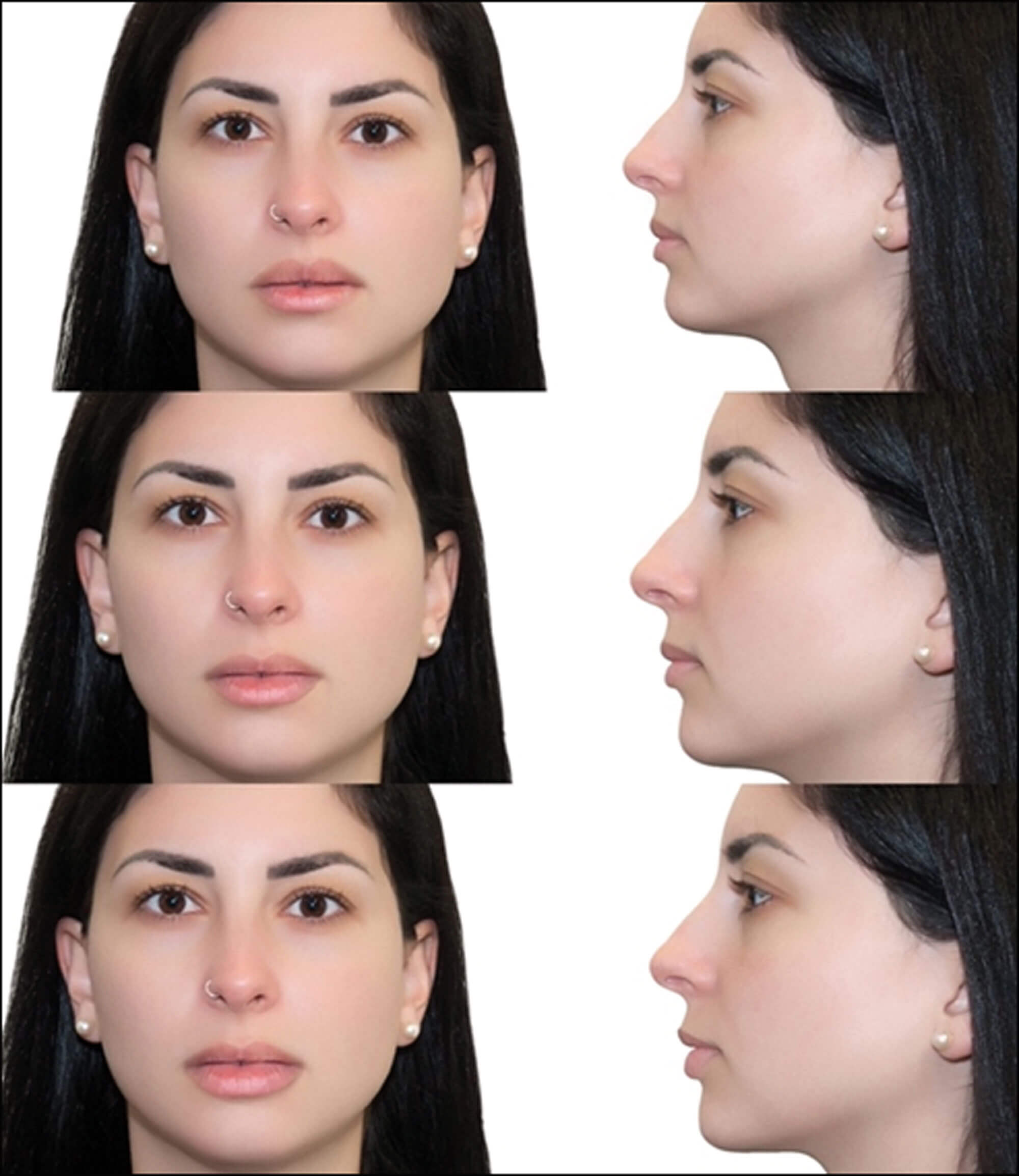 Why Is My Top Lip Smaller Than My Bottom Lip - Infoupdate.org